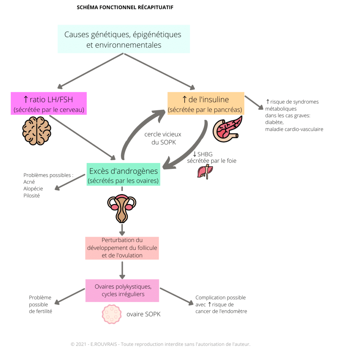 syndrome des ovaires polykystiques : comprendre la pathologie
